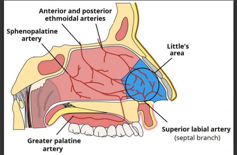 Panik Hidung Anak Selalu Berdarah, Pakar ENT Ajar Lakukan Trotter's Method!